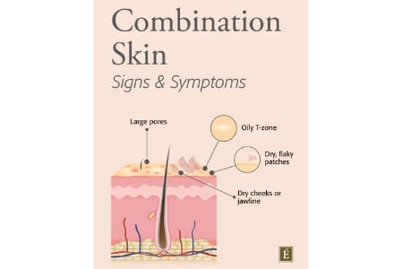 Your Quick Guide To Understanding Combination Skin | Eminence Organic ...