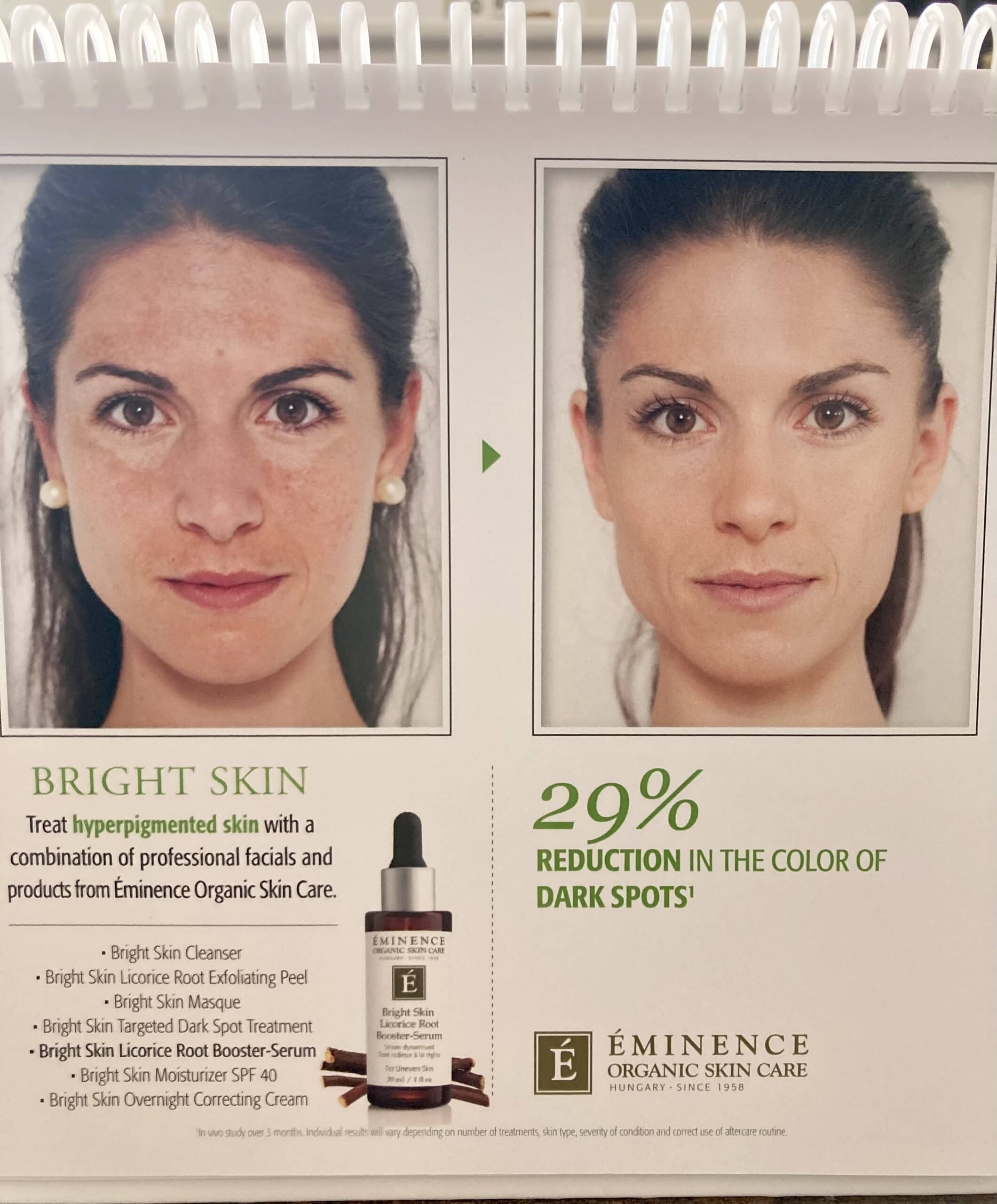 The Best Skincare For Treating Dark Spots | Eminence Organic Skincare