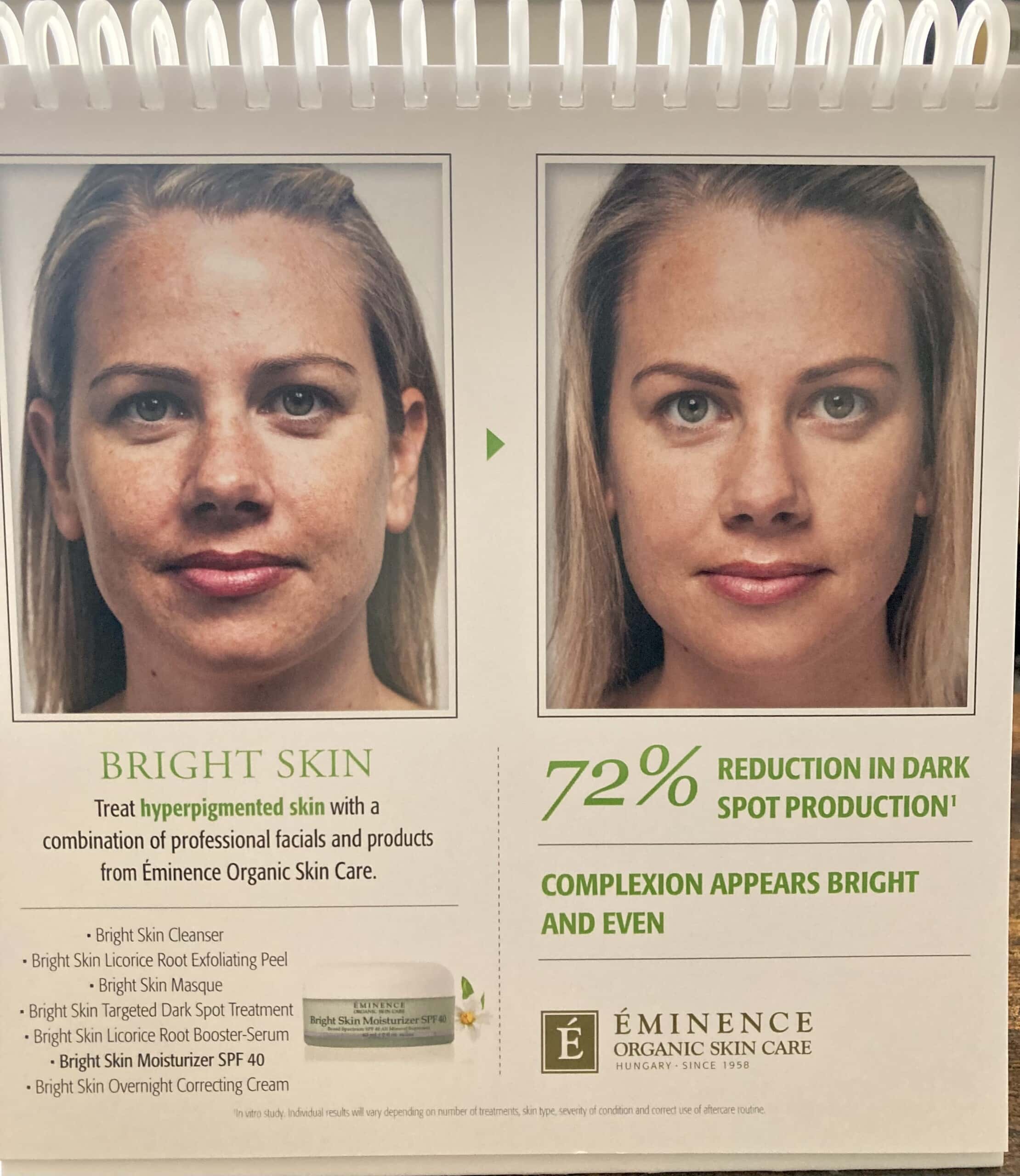 The Best Skincare For Treating Dark Spots | Eminence Organic Skincare